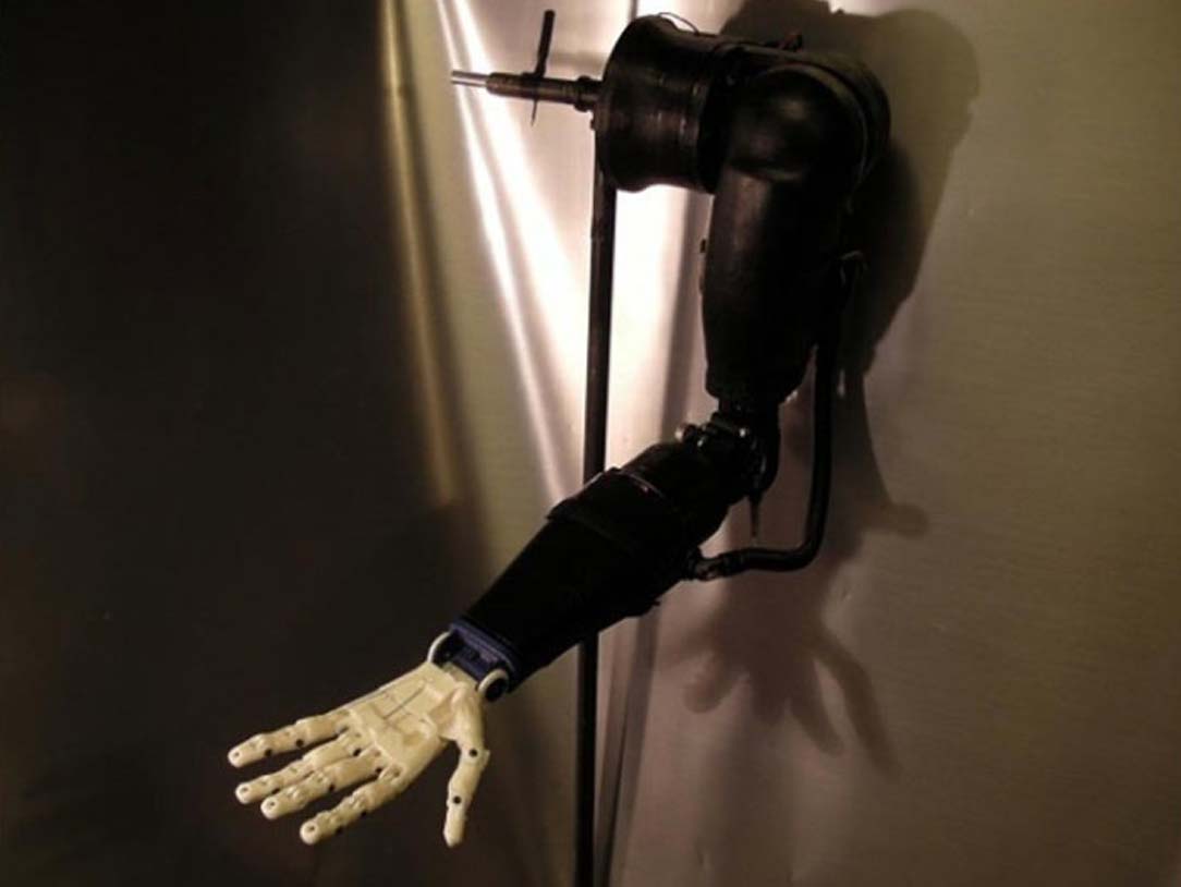 A 17 ans, il concoit une prothese de bras fonctionnelle pour moins de ...